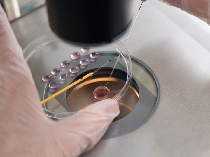 IVF clinic transferred ruined embryos to patients, lawsuits claim